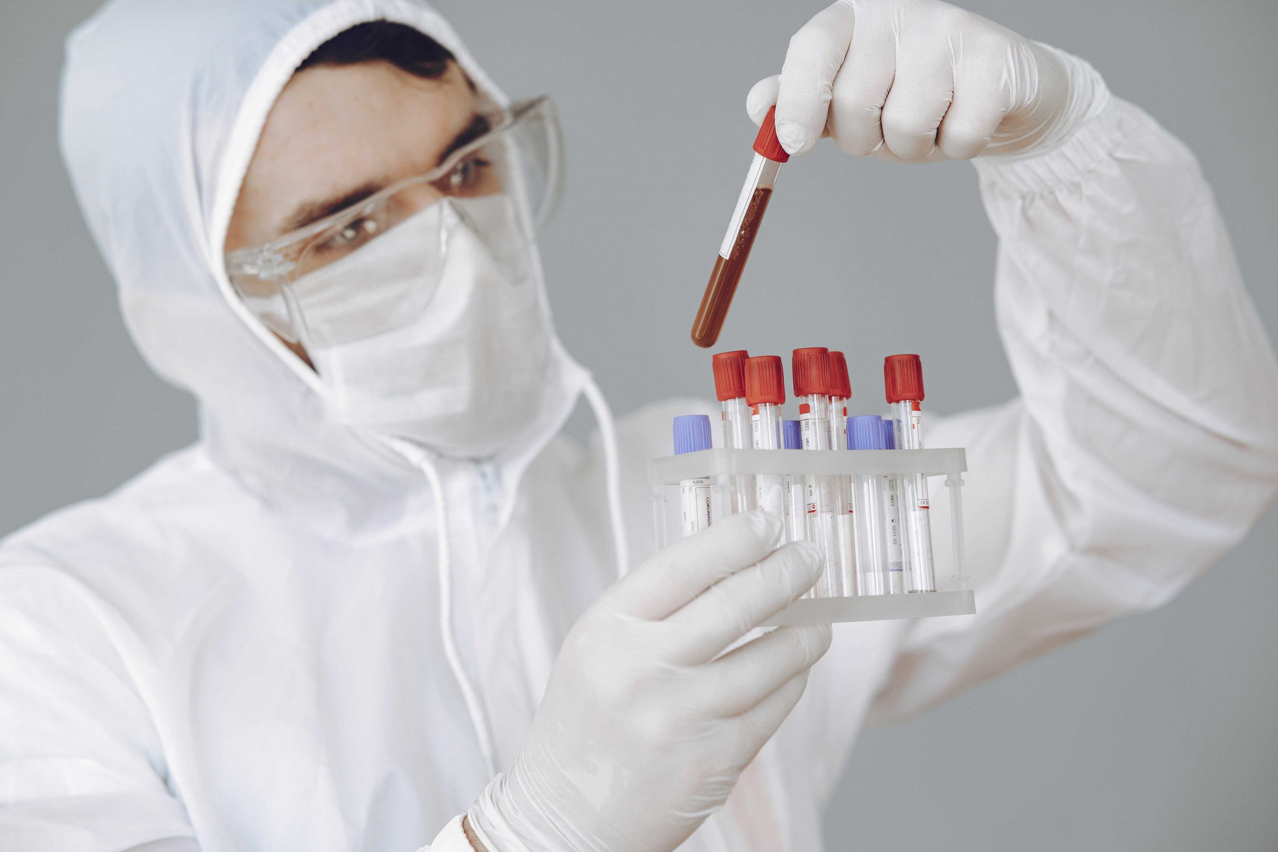 Health Check-ups Benefits, Best Laboratory for blood tests in Delhi